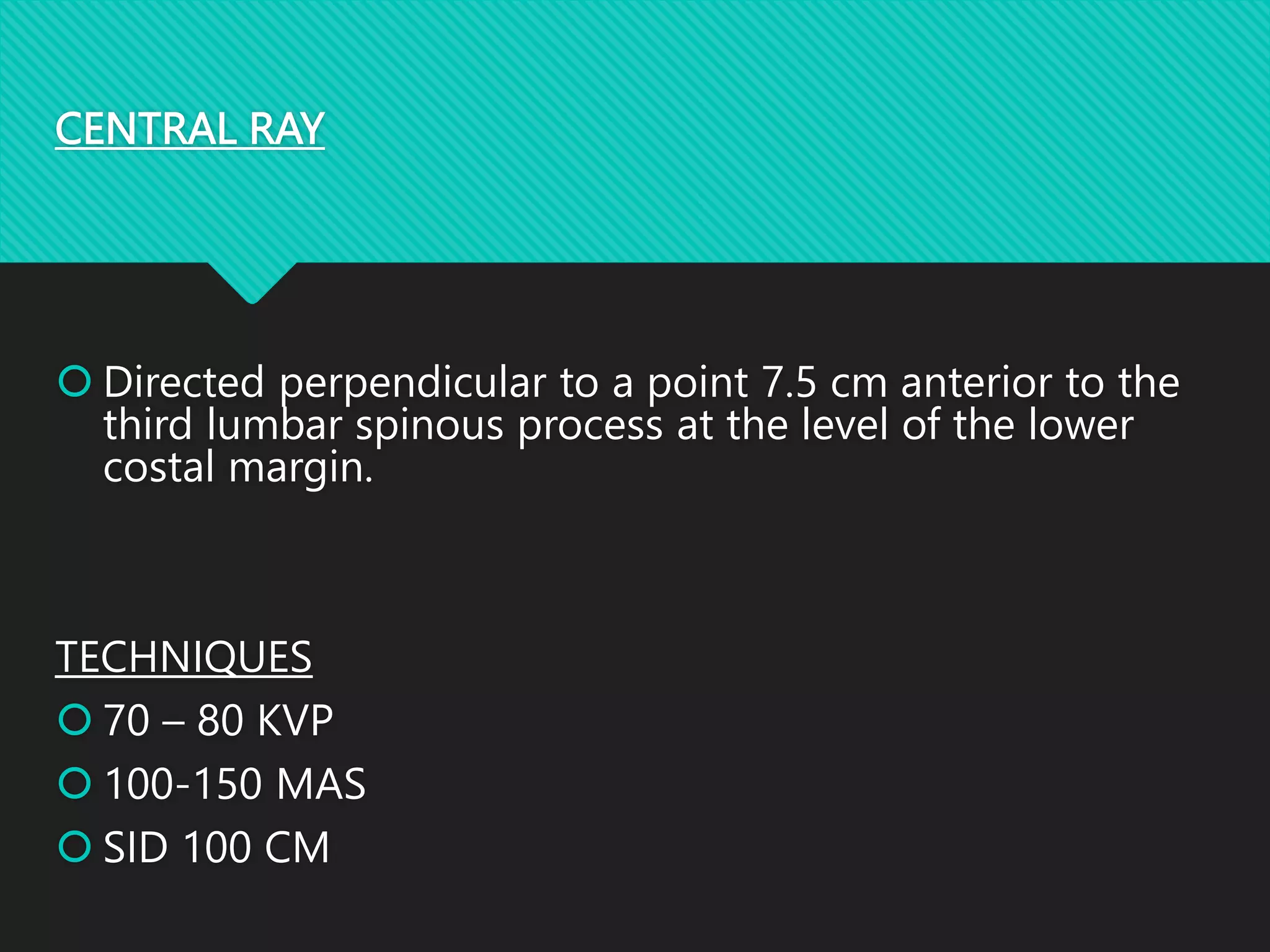 RADIOGRAPHY OF SPINE .pptx