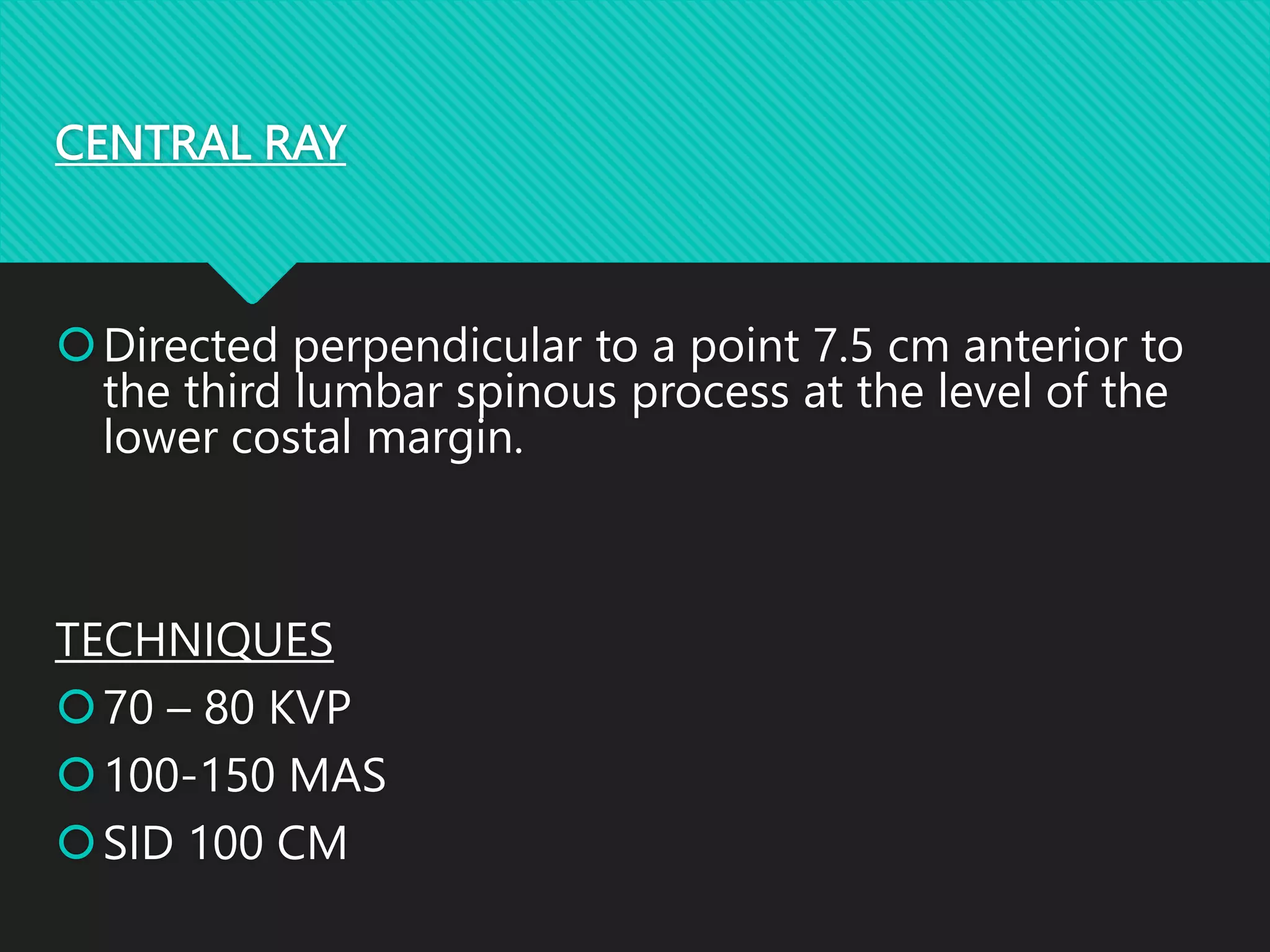 RADIOGRAPHY OF SPINE .pptx