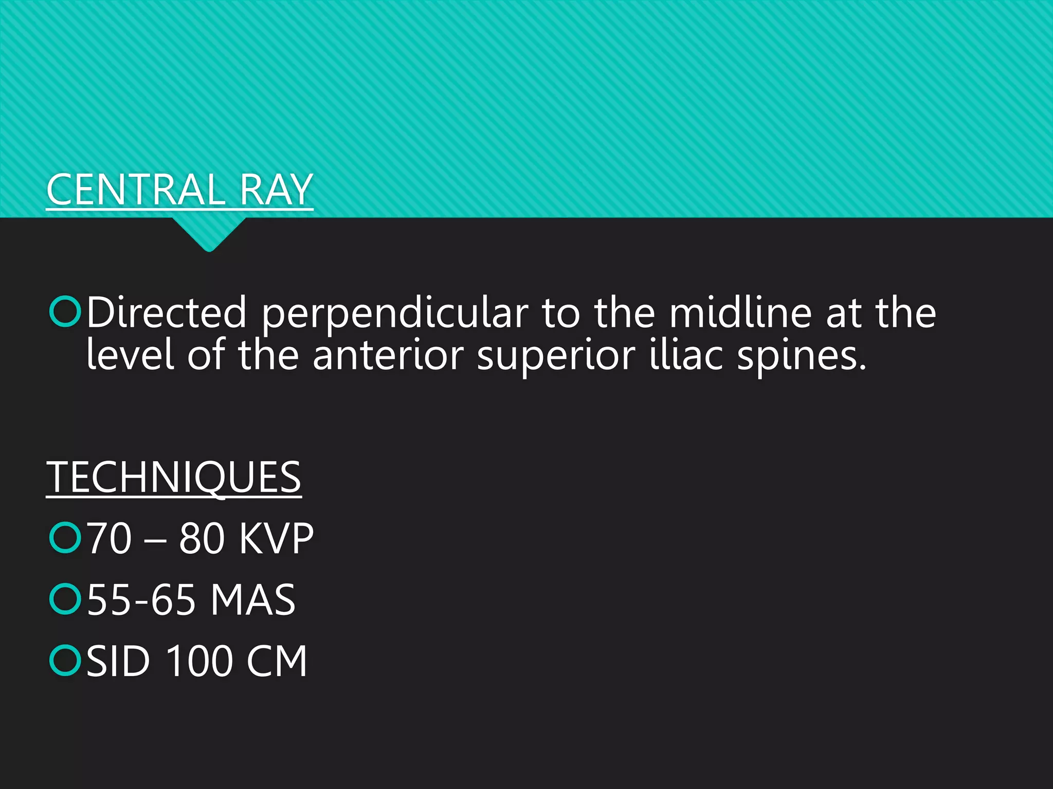 RADIOGRAPHY OF SPINE .pptx