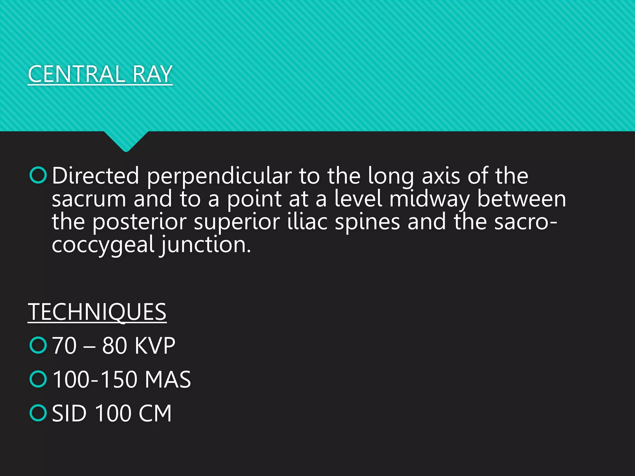 RADIOGRAPHY OF SPINE .pptx