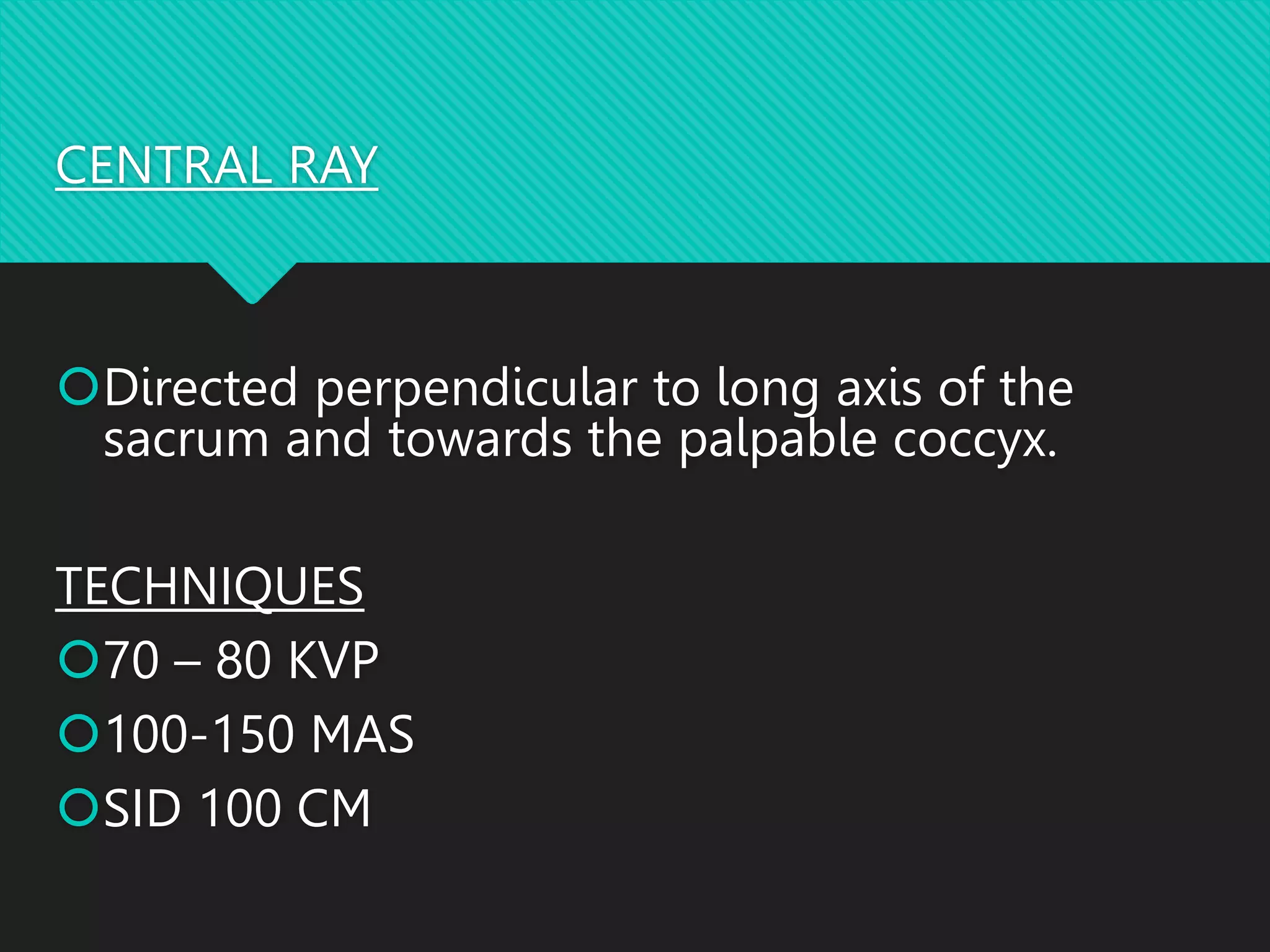 RADIOGRAPHY OF SPINE .pptx