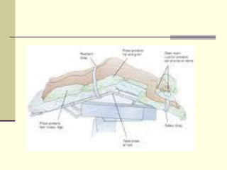 Positioning of patient during surgery | PPTX