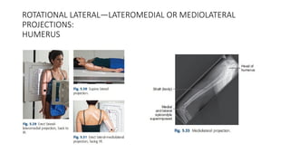positioning orthopaedic xray capture(1).pptx