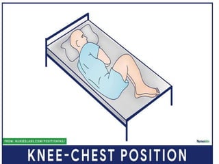 Knee Chest Position
