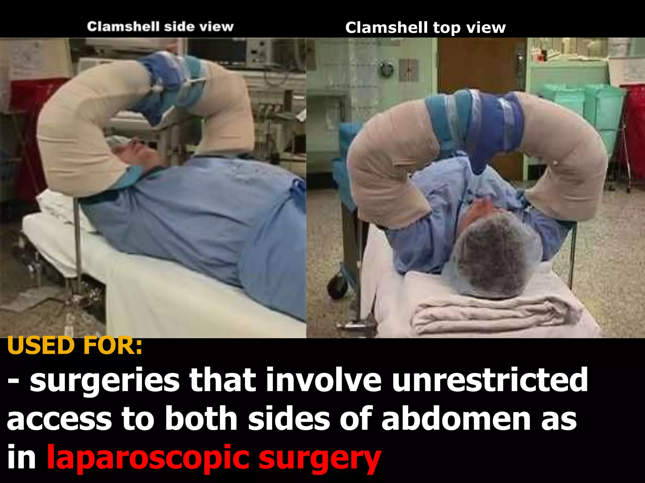 Positioning, skin prep, incision & draping | PPTX