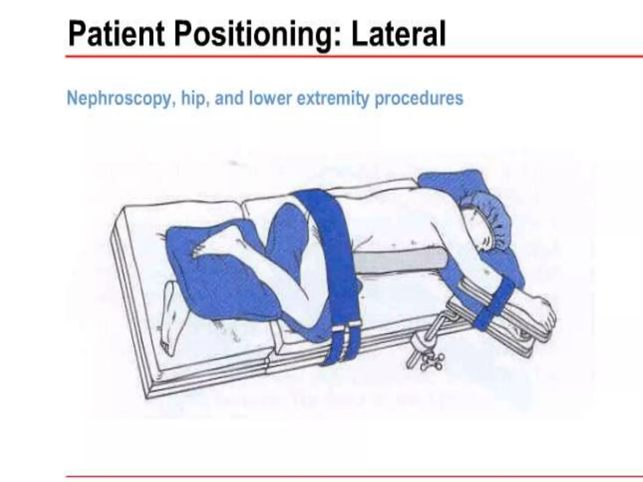Positioning, skin prep, incision & draping | PPTX