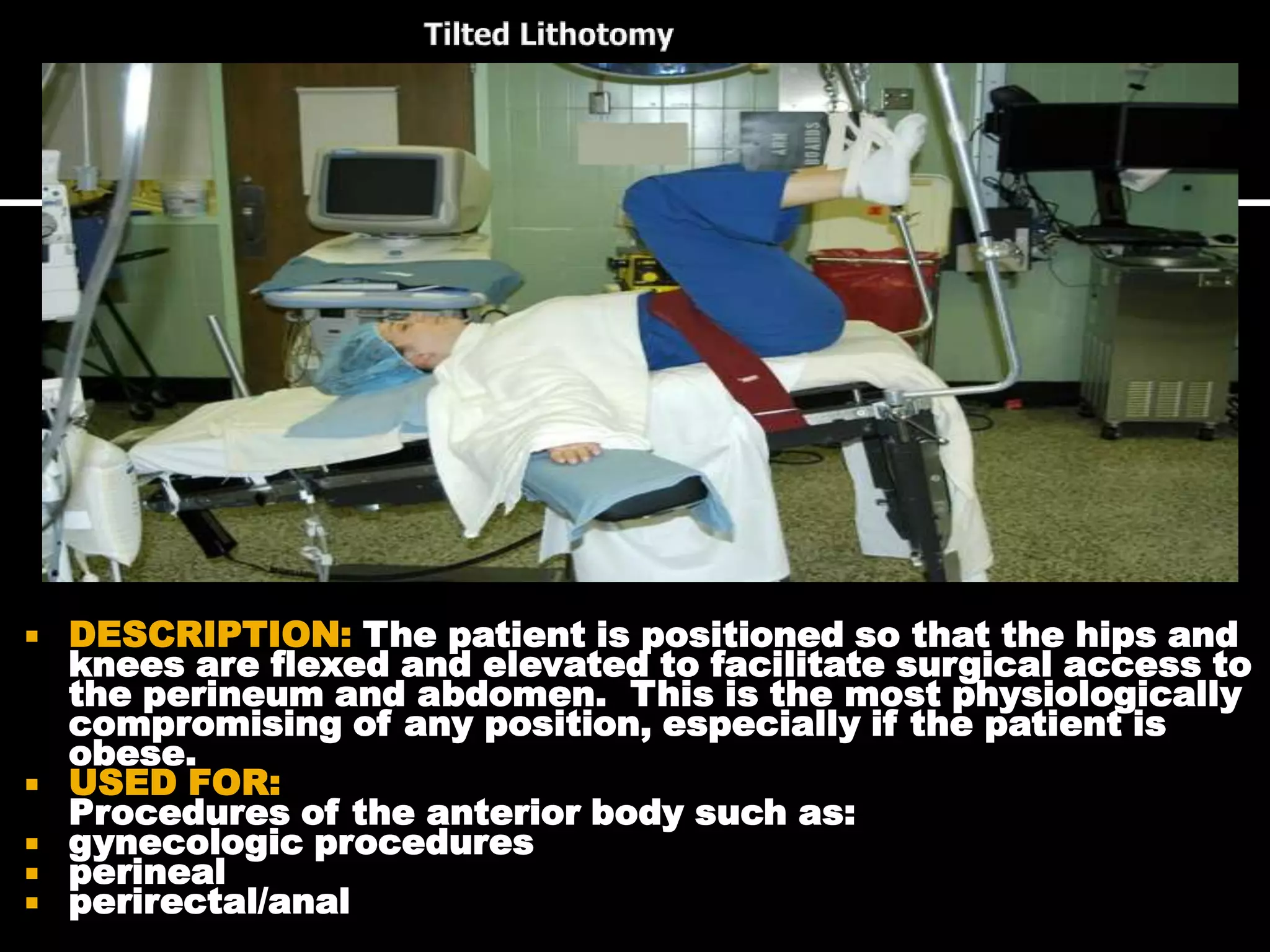 Positioning, skin prep, incision & draping | PPTX