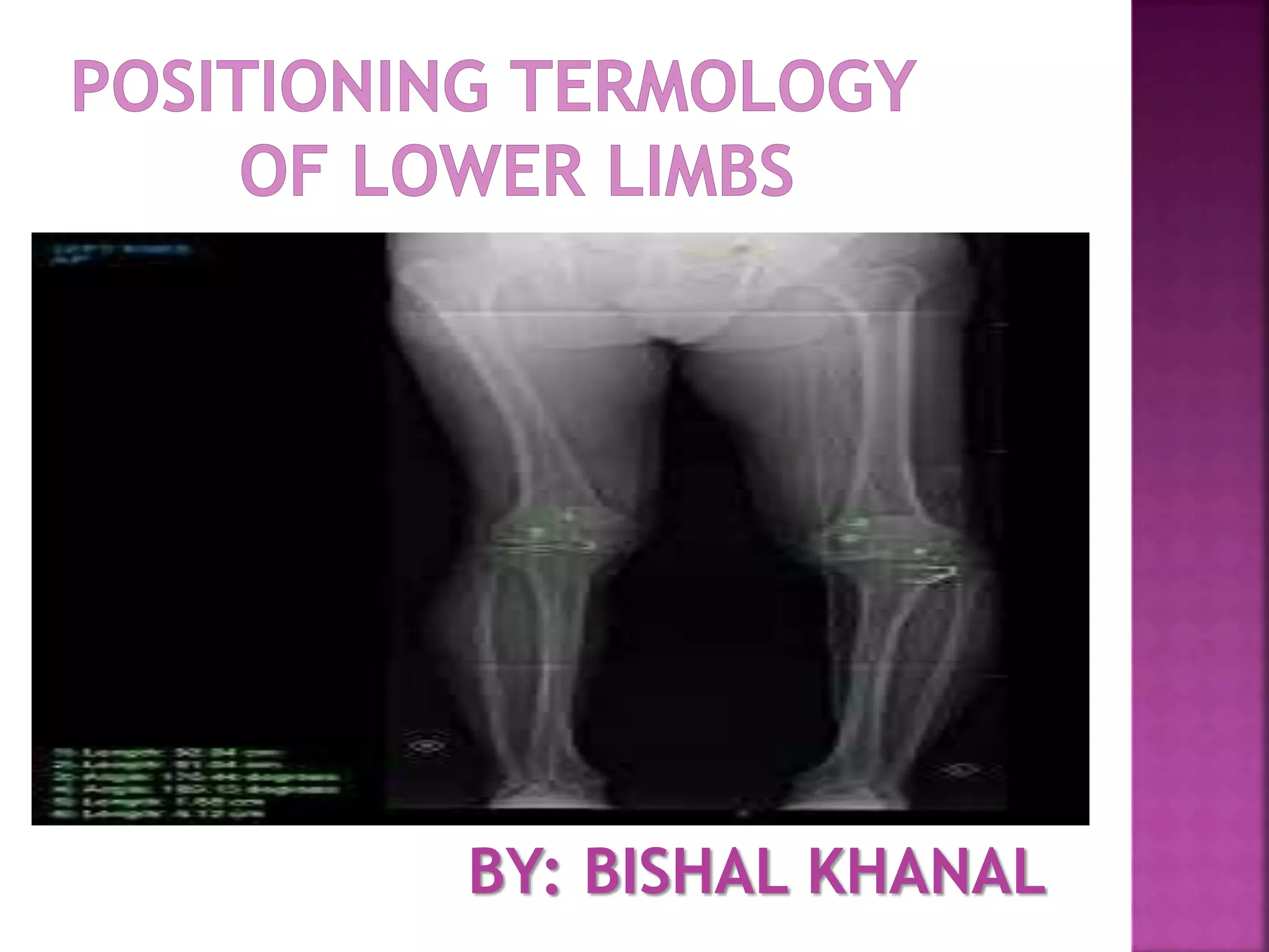 Positioning terminology of lower limbs | PPTX