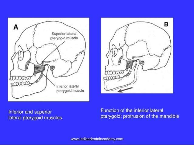Position of condyle in cl ii & iii /certified fixed orthodontic cours…