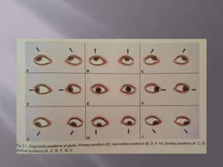 Position of gaze and axes | PPTX