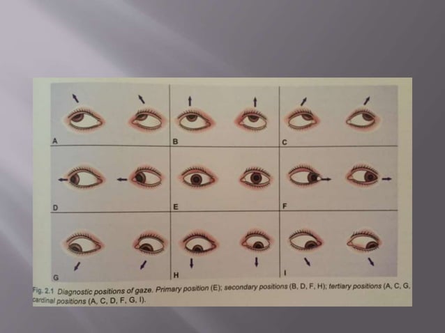 Position of gaze and axes | PPTX