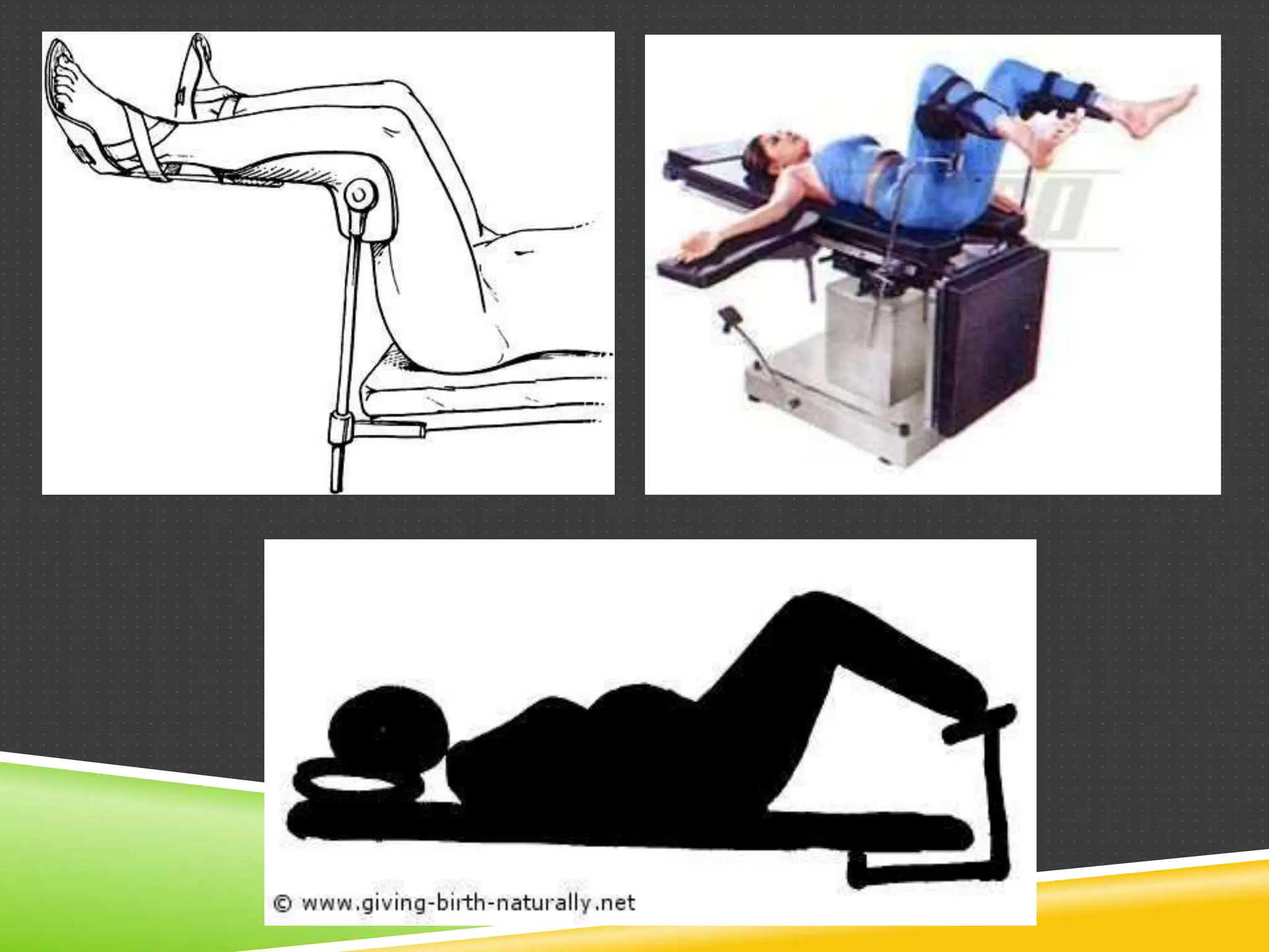 positioning of patient | PDF