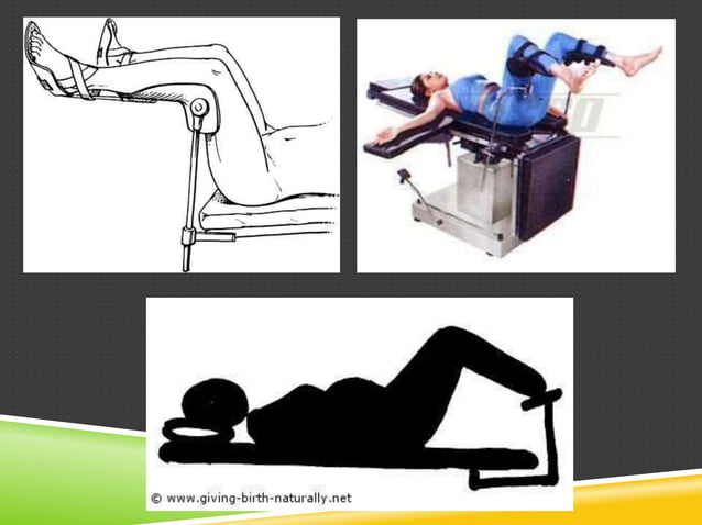 positioning of patient | PDF | First Aid | Injuries
