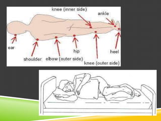 Lateral Position Nursing