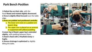 Surgical Positions in CP Angle tumors.pptx