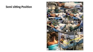 Surgical Positions in CP Angle tumors.pptx