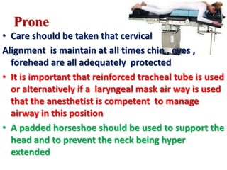 positions in OT . power point presentation | PPTX