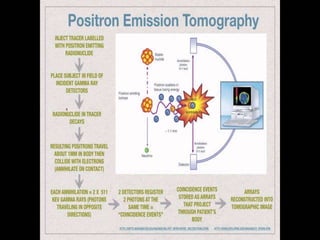 POSITRON EMISSION TOMOGRAPHY.pptx