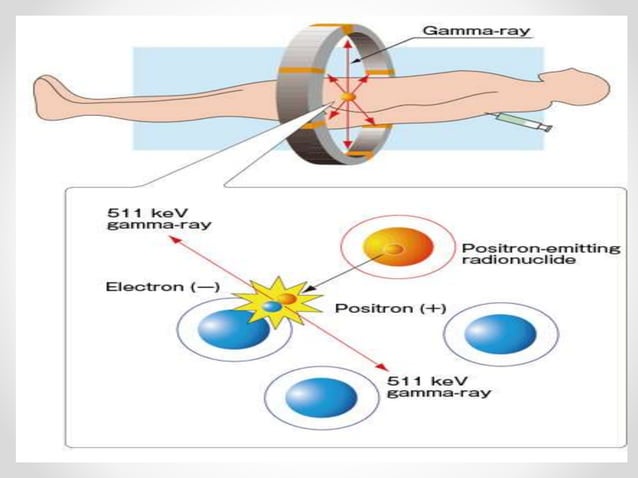 POSITRON EMISSION TOMOGRAPHY.pptx | Chemistry | Science