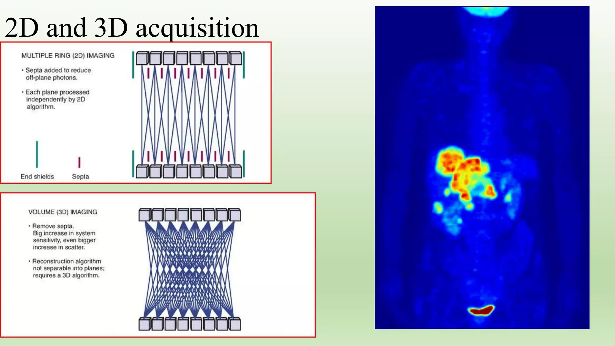 Positron emission tomography pet scan and its applications | PPTX
