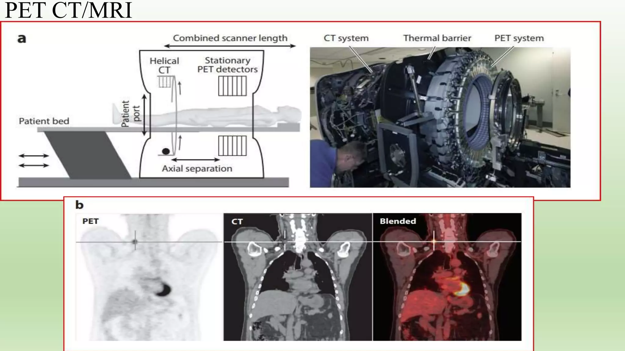 Positron emission tomography pet scan and its applications | PPTX
