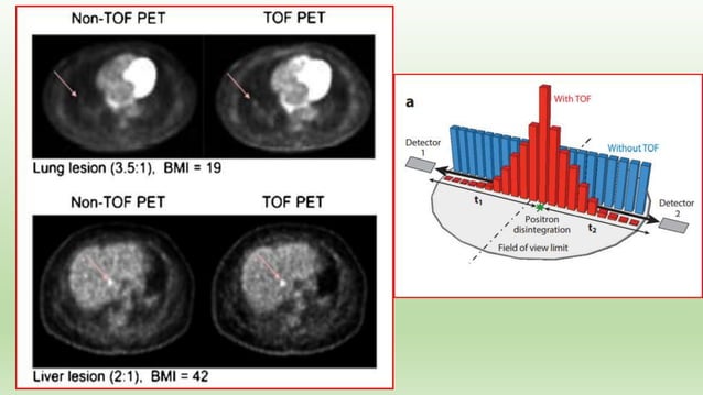 Positron emission tomography pet scan and its applications | PPTX