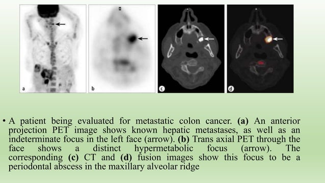 Positron emission tomography pet scan and its applications | PPTX