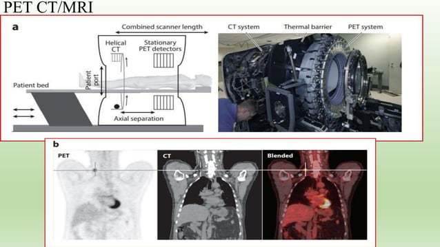 Positron emission tomography pet scan and its applications | PPTX