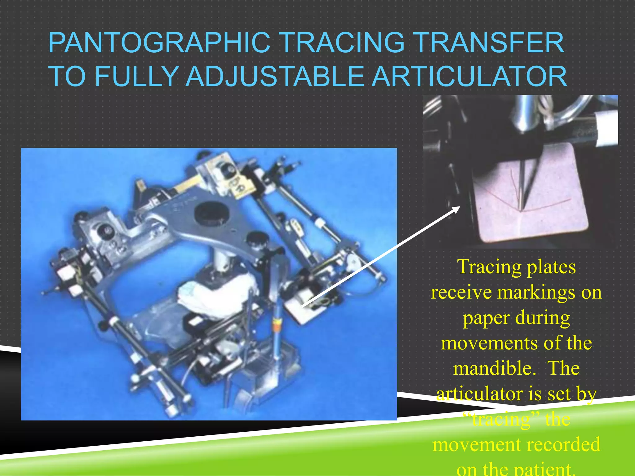 Posselt’s envelope | PPTX