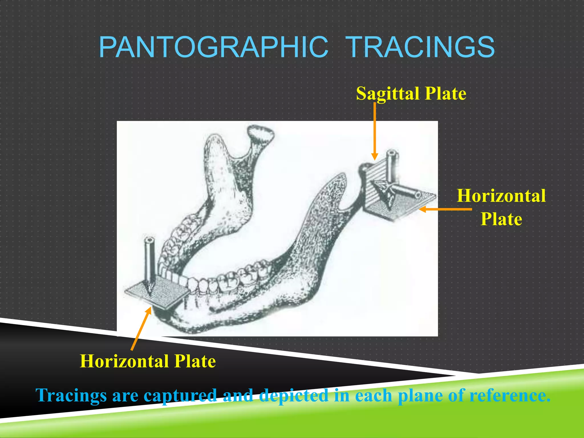 Posselt’s envelope | PPTX