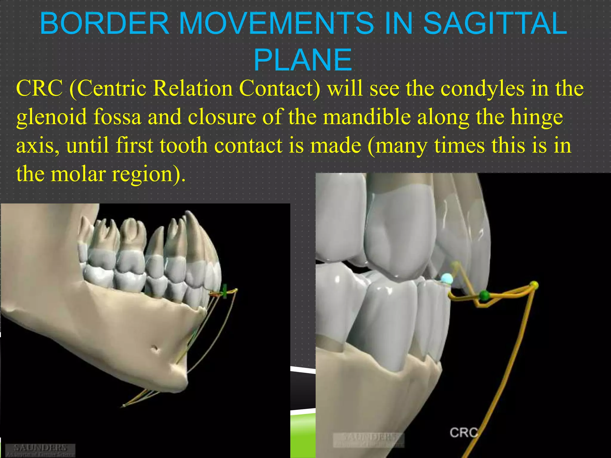 Posselt’s envelope | PPTX