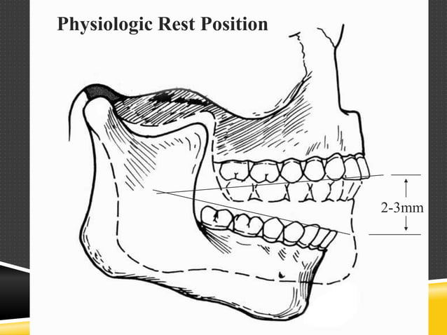 Posselt’s envelope | PPTX