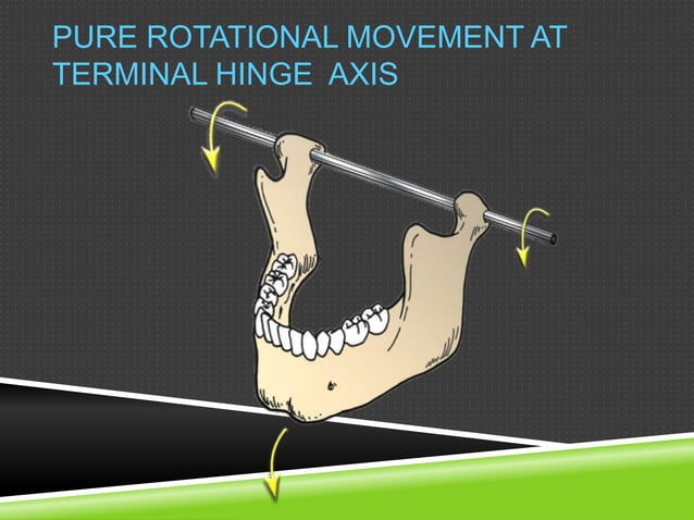 Posselt’s envelope | PPTX