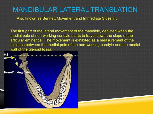 Posselt’s envelope | PPTX