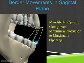 Posselt’s envelope | PPTX