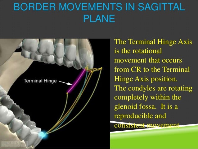Posselt’s envelope