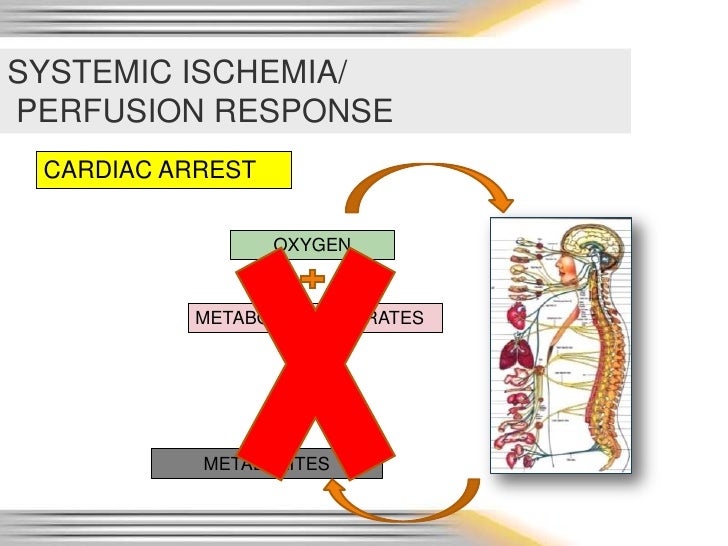 Post cardiac arrest syndrome