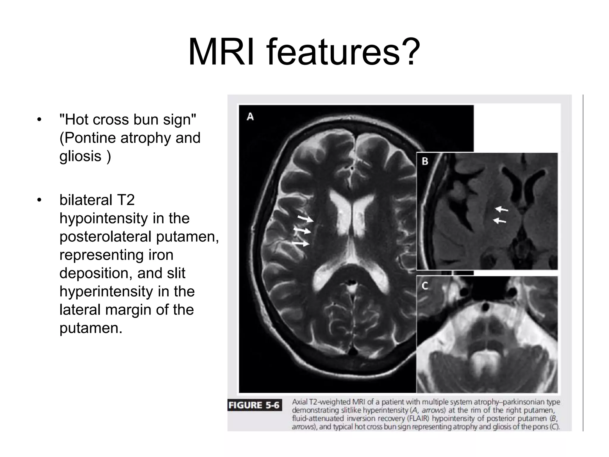 Post-Congress Workshop - Parkinsonism.ppt
