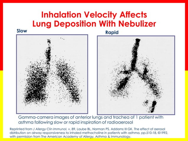 Post discharge use of nebulized pulmicort respules® in children after ...