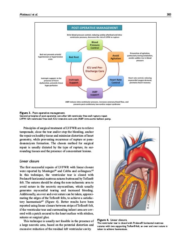 Post infarction left ventricular free-wall rupture