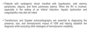Post-MI Ventricular Septal Rupture.pptx