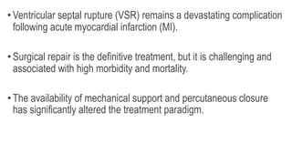 Post-MI Ventricular Septal Rupture.pptx