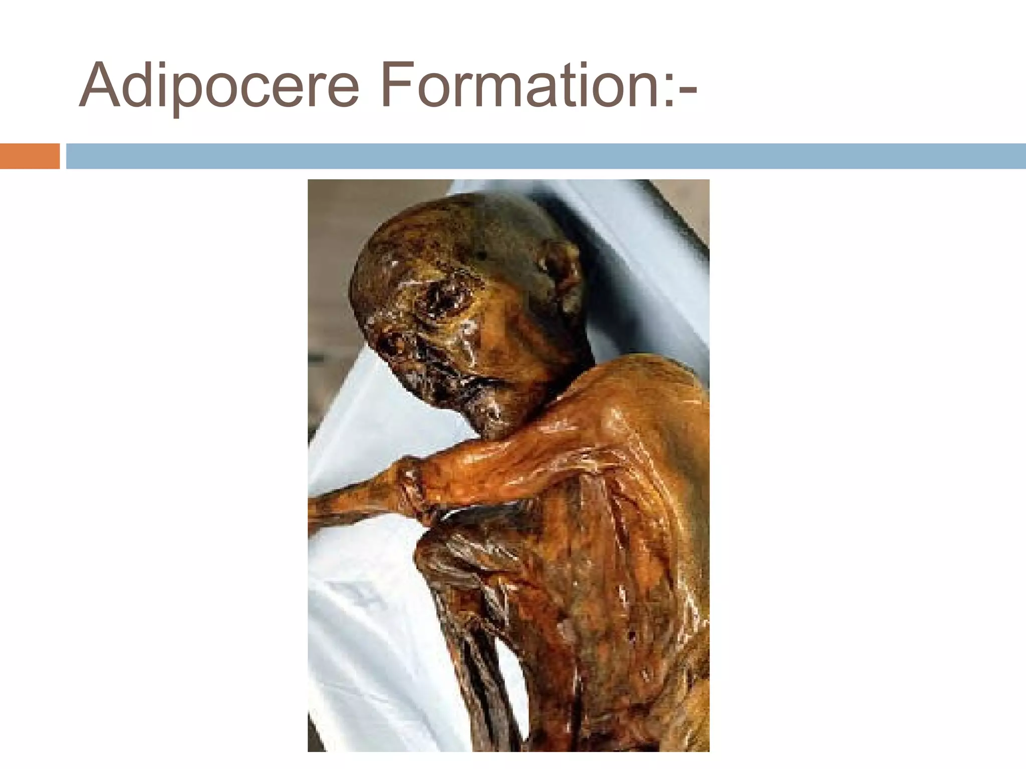 Post Mortem Changes | PPT