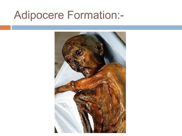 Post Mortem Changes | PPT | Death, Injury, or Military Conflict | Sensitive Topics