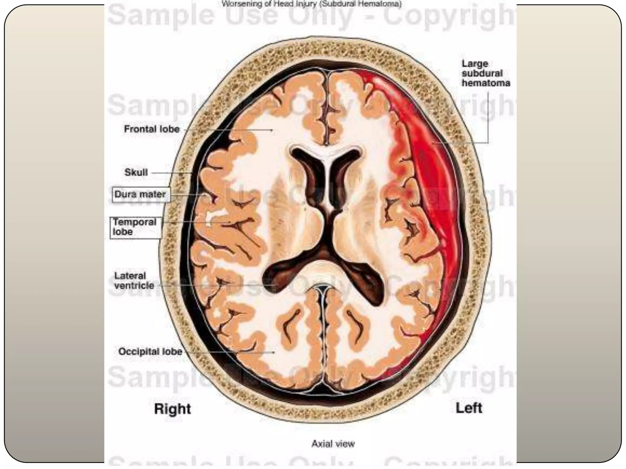 Post mortem examination(autopsy) | PPTX