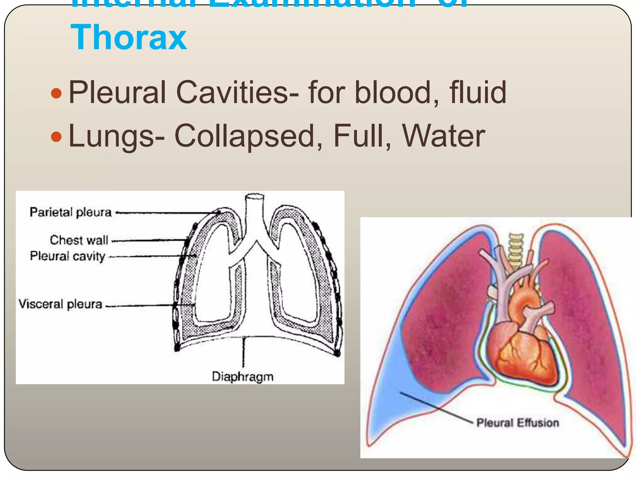 Post mortem examination(autopsy) | PPTX