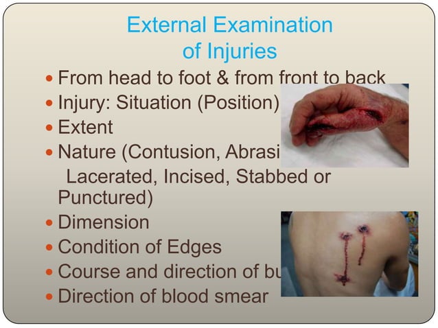 Post mortem examination(autopsy) | PPTX | Death, Injury, or Military ...