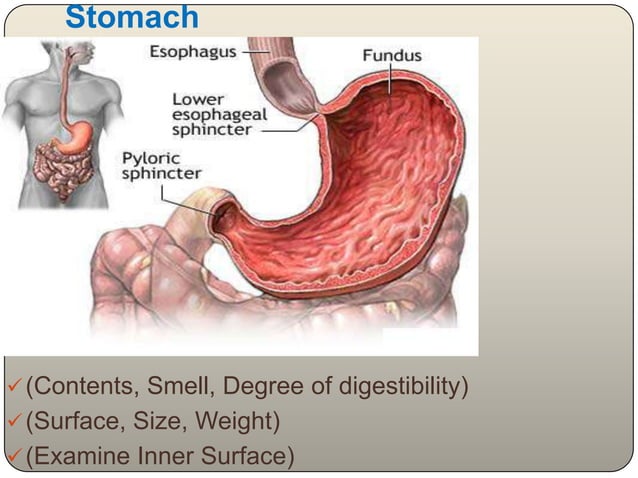 Post mortem examination(autopsy) | PPTX | Death, Injury, or Military ...