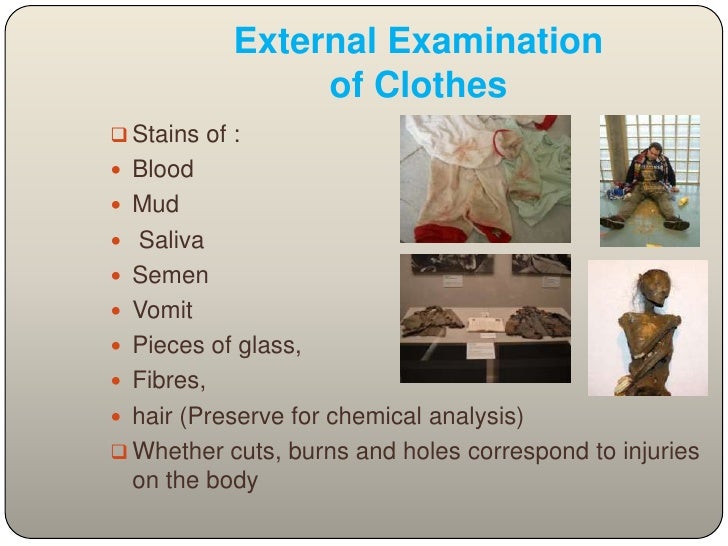 Post mortem examination(autopsy)