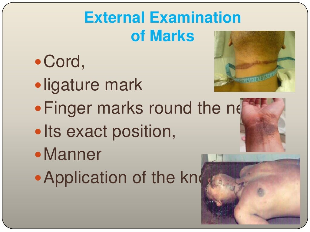 Post Mortem Examinationautopsy